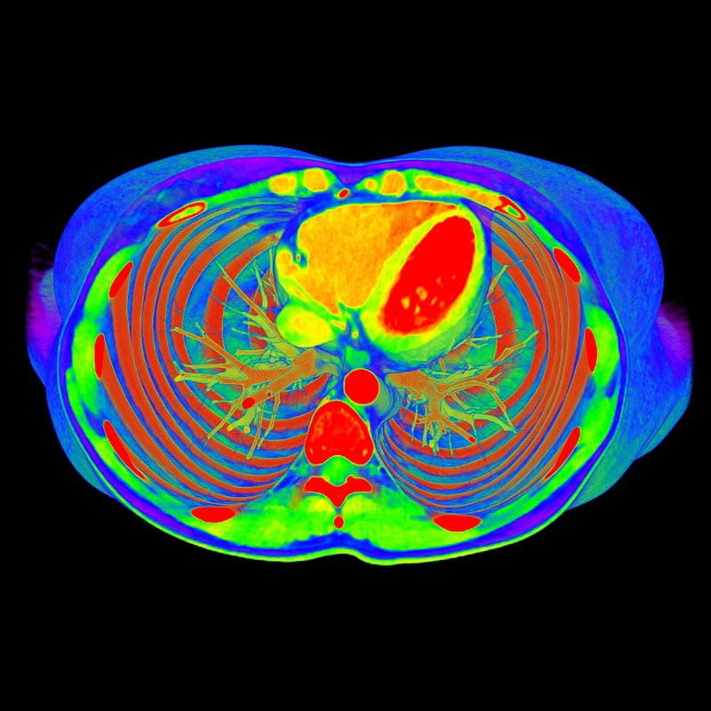 16th John Vane Memorial Symposium on Prostacyclin Science & Pulmonary ...